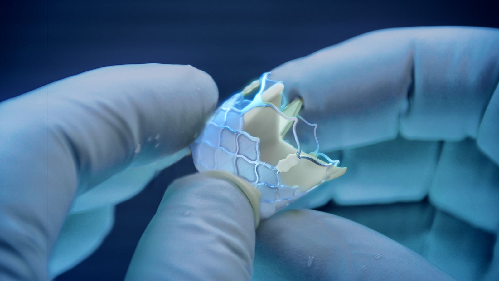 Revolutionising the heart valve replacement market | Anteris Technologies